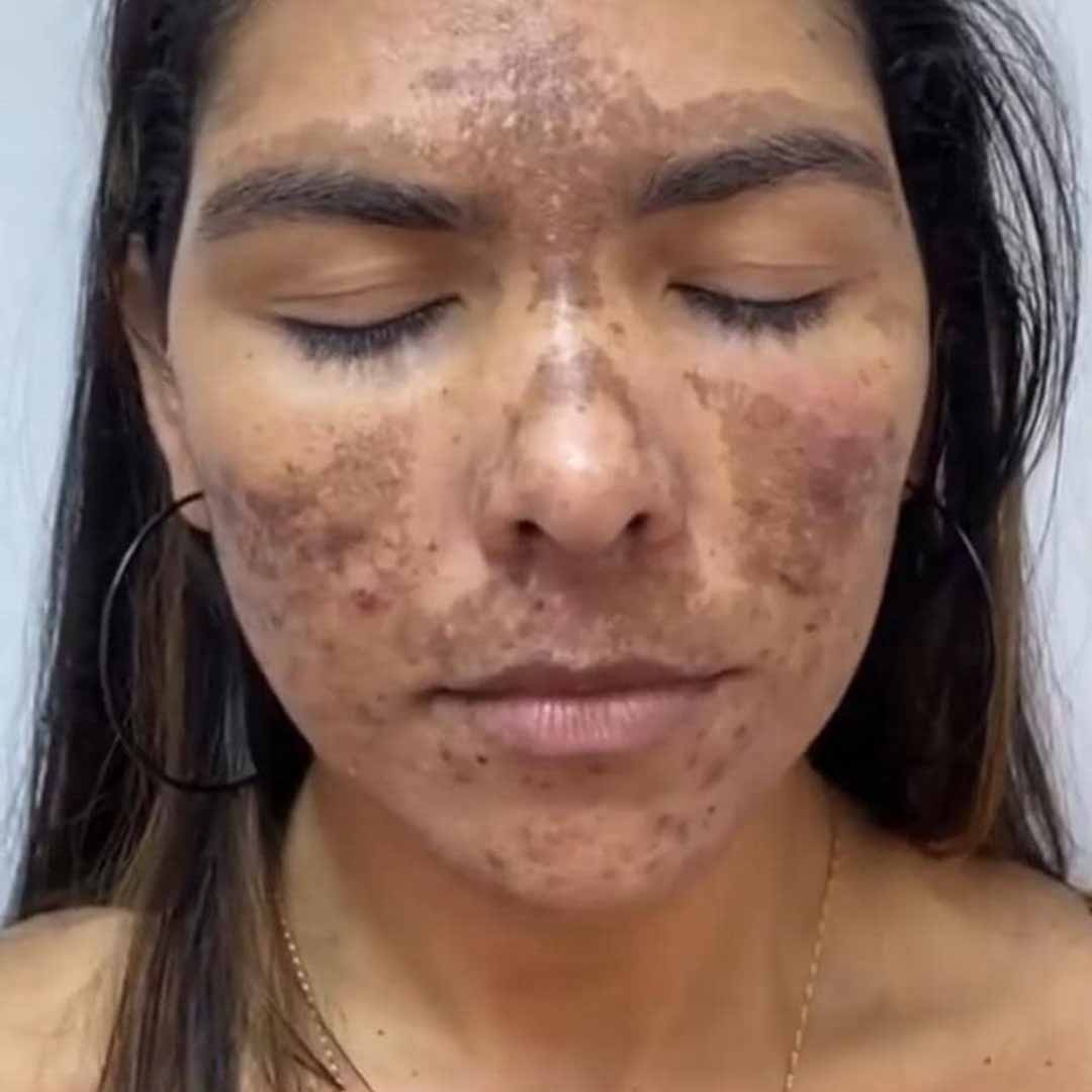Portada - Logana Medical Spa - España